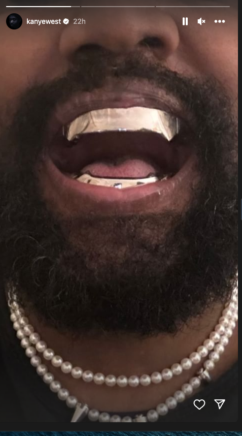 Kanye West Buys A New Grill Reportedly Worth $850K